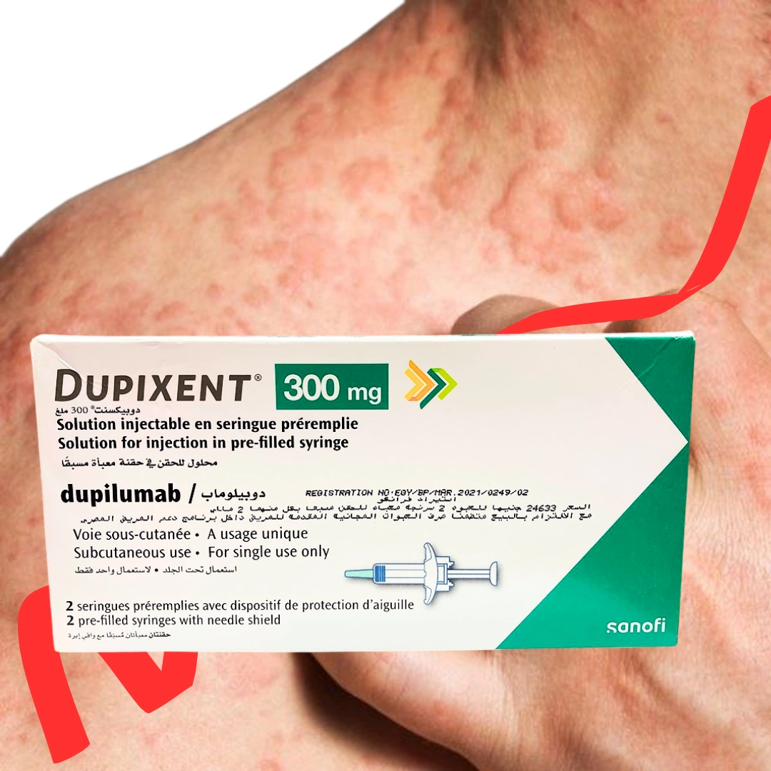 Dupixent 300 Mg Injection – Targeted Biologic For Eczema, Asthma ...